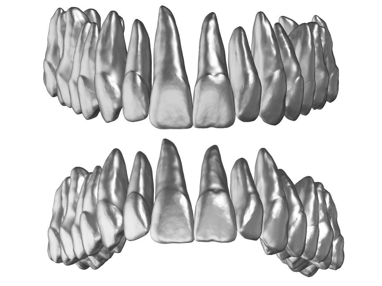 3SHAPE - FULL ARCH HD UPPER LIBRARY 2 with ROOTS - DENTAL CAD SHOP